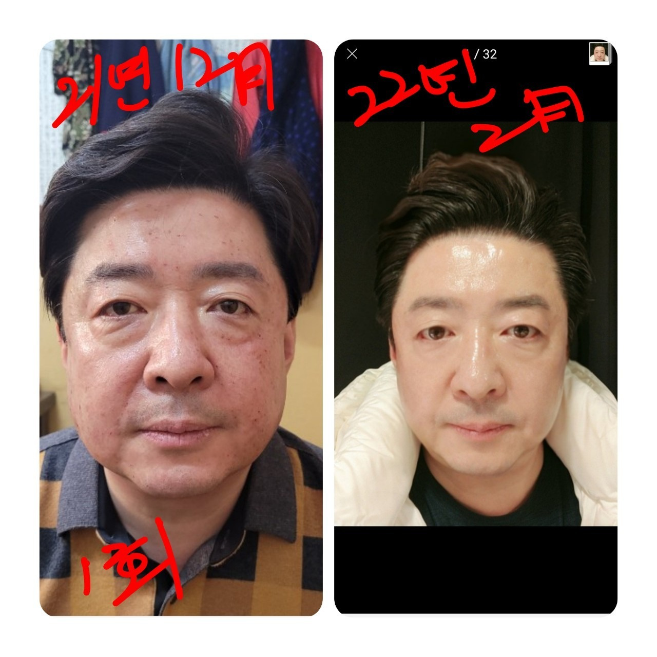 유명한 특허발명자의 자연치유법으로 젊어지게되는 약초탕 세신 기치유받아보세요 경기도 고양시 일산동구 백석동 비즈프로필
