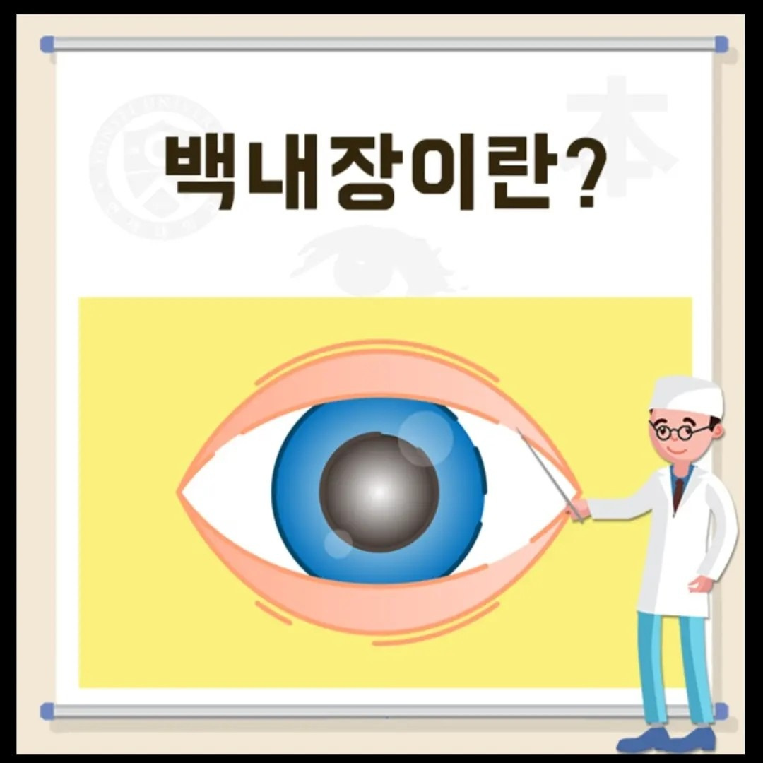 백내장이란 백내장 종류 백내장수술후 보호안경은 으뜸플러스안경 수원정자점 경기도 수원시 장안구 정자동 비즈프로필