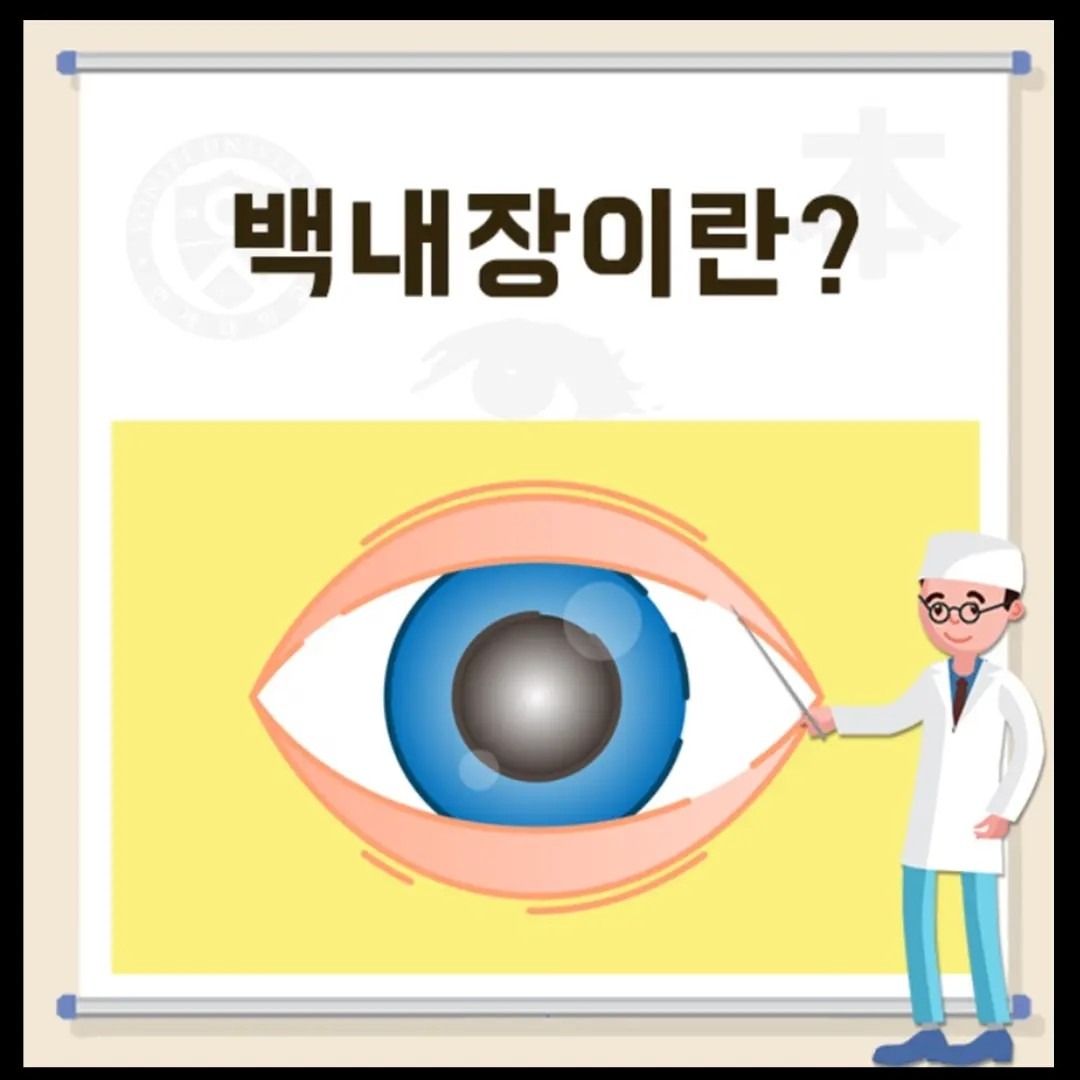 백내장이란 백내장 종류 백내장수술후 보호안경은 으뜸플러스안경 수원정자점 경기도 수원시 장안구 정자동 비즈프로필